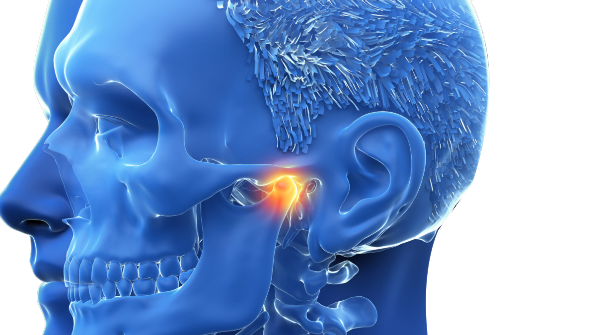 TMJ Disorders: Symptoms & Treatment | Tek TMJ Center